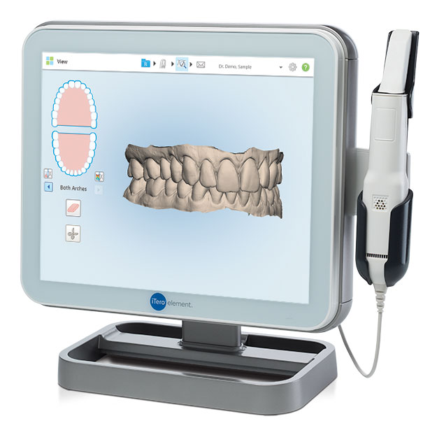 iTero 3D Scanner - Oxford House Dental Practice